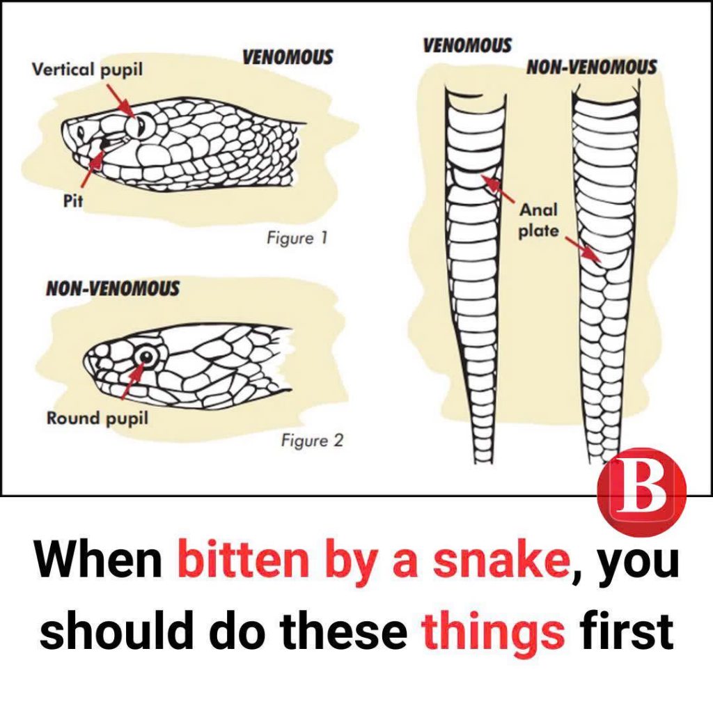 Snake bite signs and first aid you need to know – Tiny House Zone