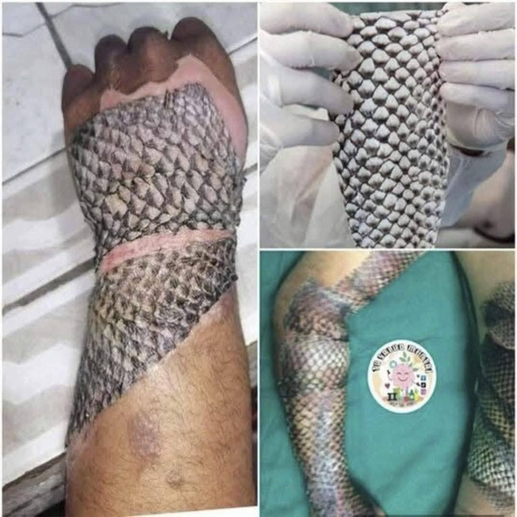 Tilapia Skin: An Innovative Alterna – Tiny House Zone